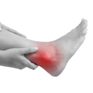 Enkelblessure - Fysio IJsselmonde